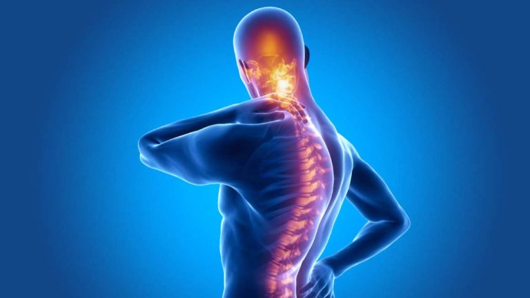 Ankylosing Spondylitis (AS): Symptoms, Causes & Treatment - Litho